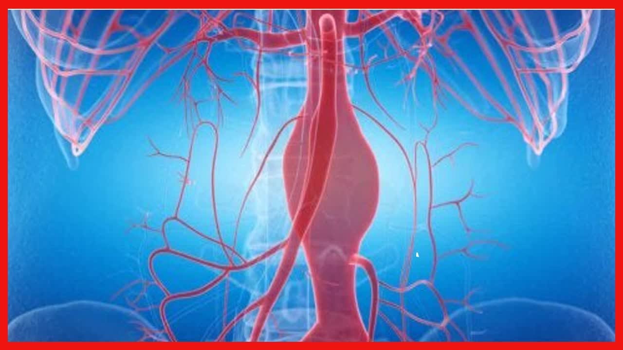 Arterielle Hypertonie: Die körperlichen Auswirkungen von Bluthochdruck ...