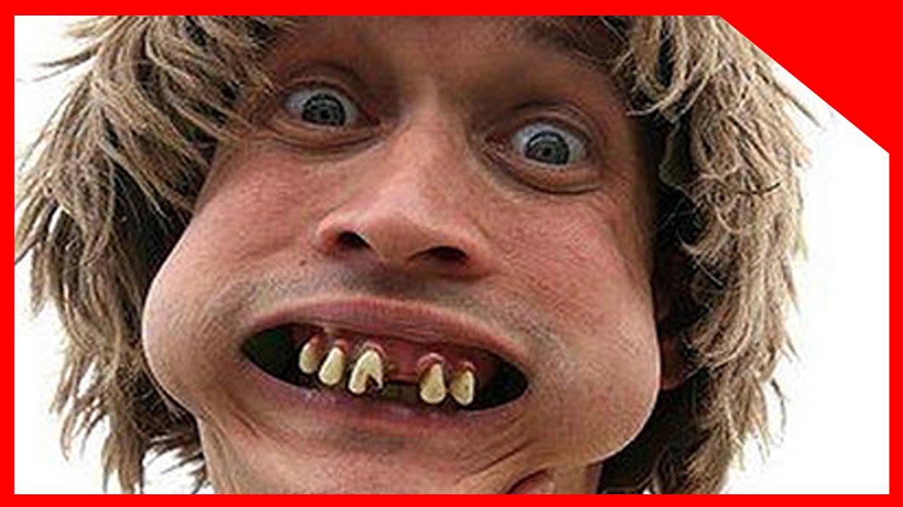 Como Quitar el Dolor de Dientes Destemplados - YouTube