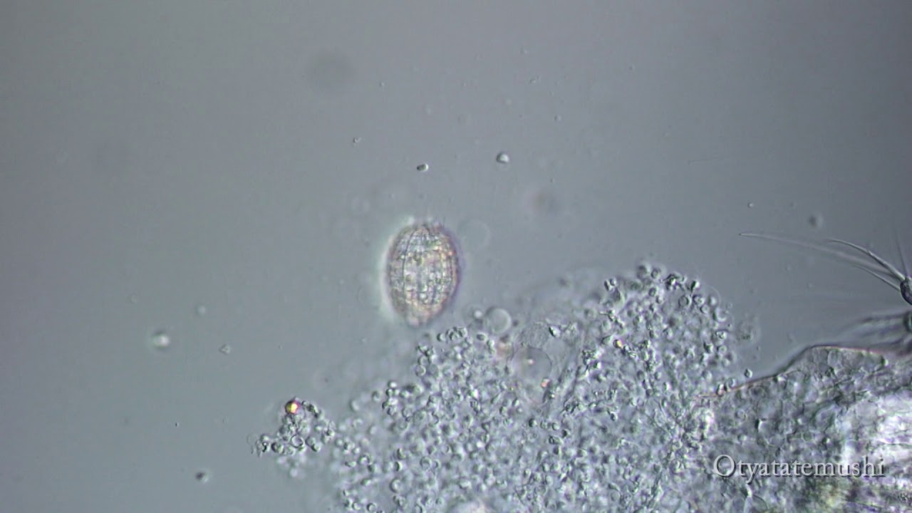 潰れたノープリウスの内容物を食べるコレプスの一種（Coleps sp.） - YouTube