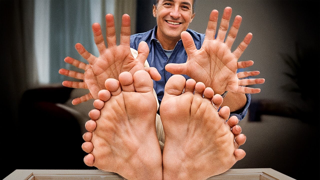 20 Fingers, 20 Toes: What Would It Be Like to Have Extra Digits? 🦶 ...