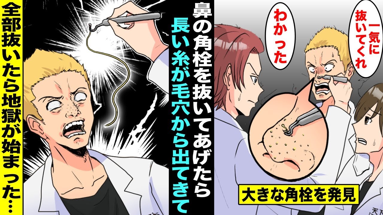 【漫画】友達の鼻にあった大きな角栓を抜いたら白くて長い糸がにゅるにゅると出てきて引っ張り続けたら…「プツンっ!」全部抜いた瞬間からとんでもない