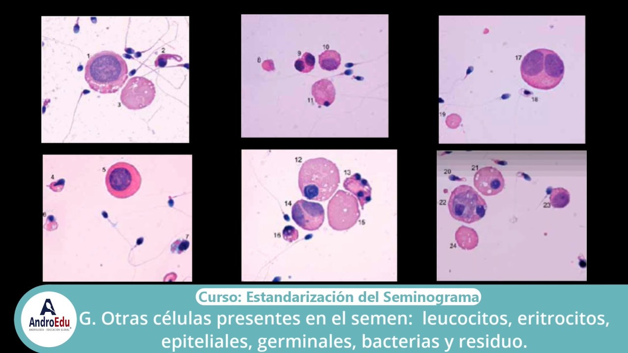 Curso Estandarización del Seminograma - YouTube
