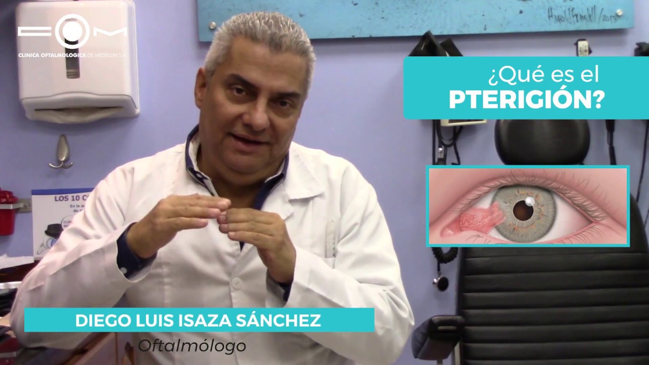 ¿Qué es el Pterigion? - YouTube