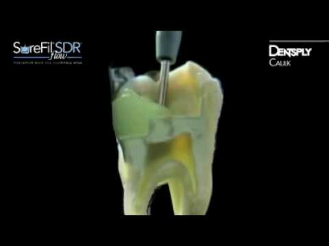 SureFil SDR Flow - YouTube