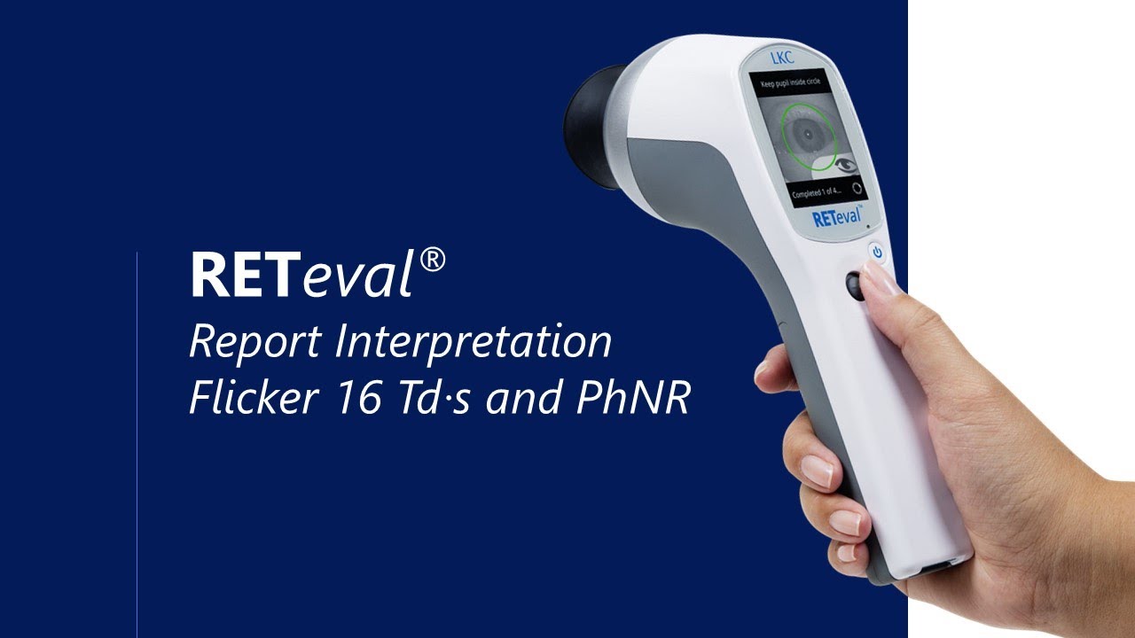 Interpretation of the RETeval Flicker 16 Tds and PhNR test reports ...
