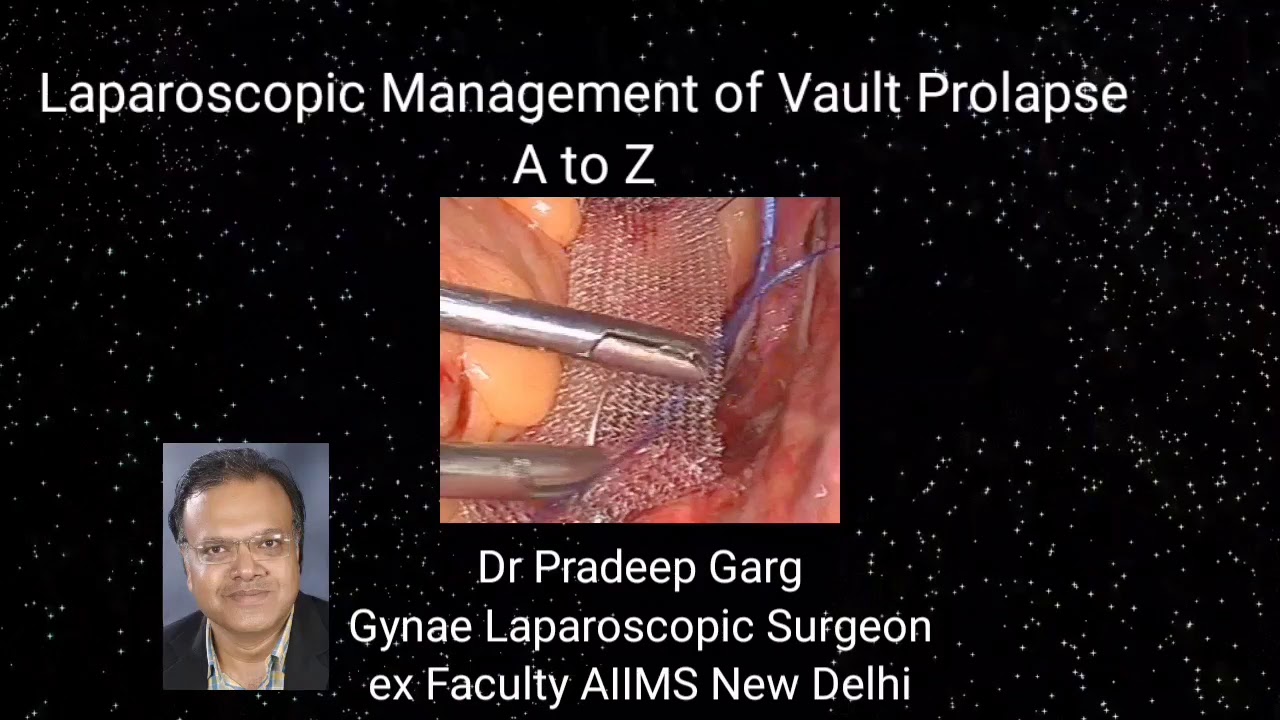 Lap Management of Vault Prolapse: A to Z, & Anatomy of ureter, by Dr ...
