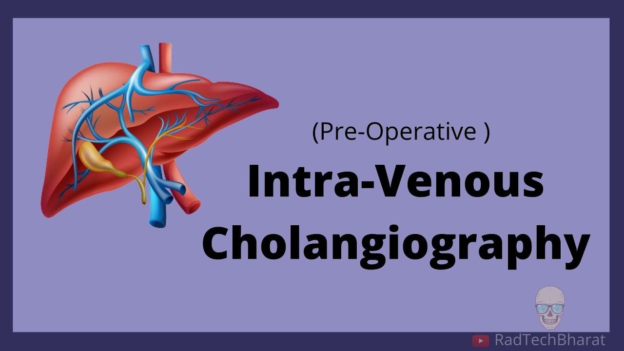 Intra Venous Cholangiography (IVC) // Pre operative Cholangiography ...