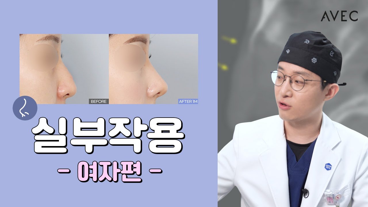 코 실리프팅 부작용 ㅣ코 실 제거 사례 Mp4 Youtube