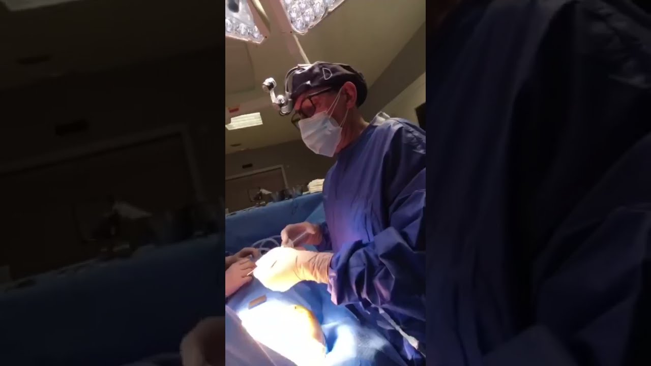 Aumento de pecho con prótesis redondas Sebbin | Doctor Diego Tomás ...