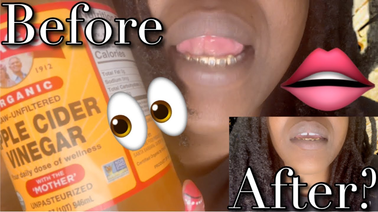 Lightening My Lips With ACV?! | Mouth Tour - YouTube