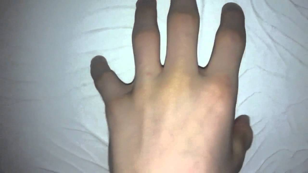 An Epic Hand Part 3 ! - YouTube