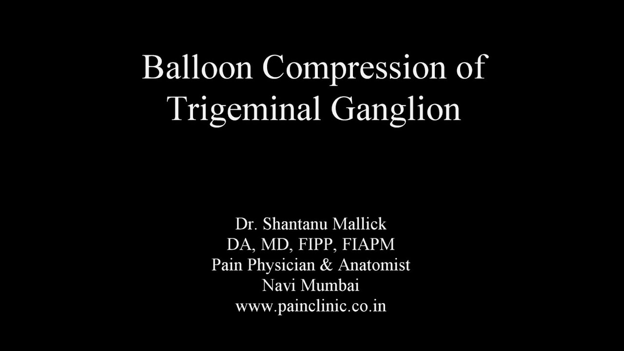 Balloon compression of Trigeminal Ganglion - YouTube