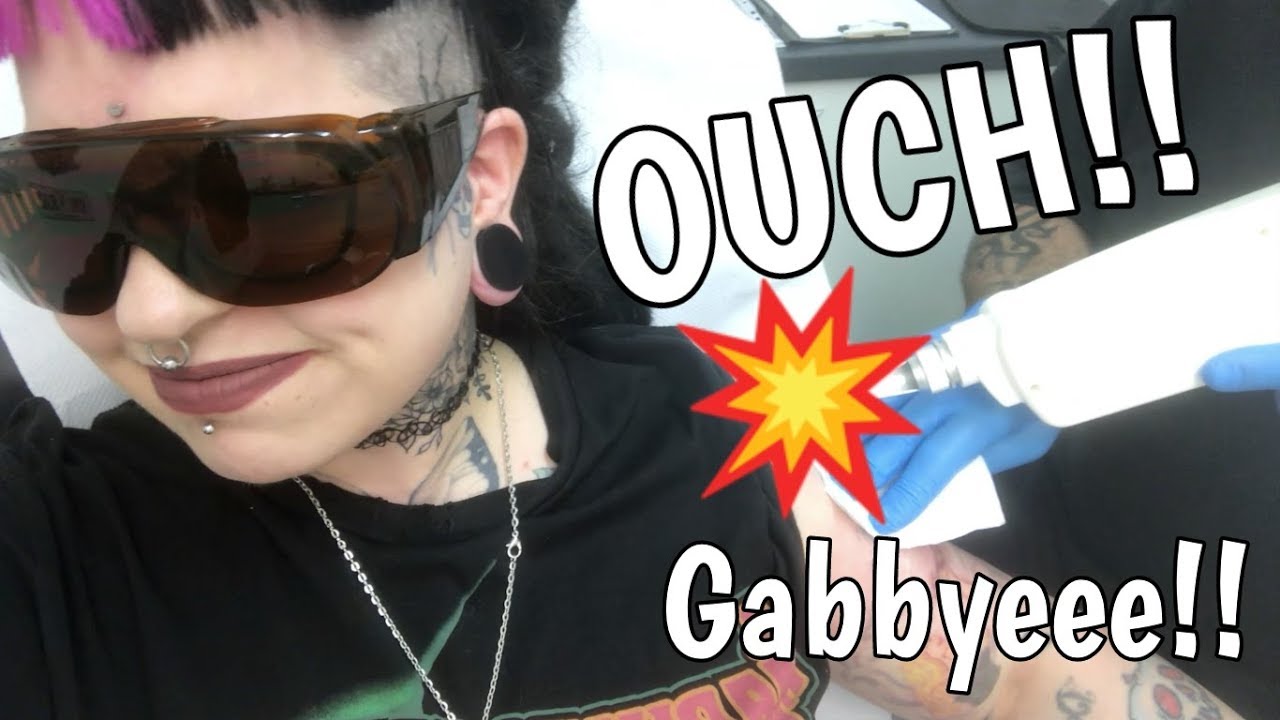 Removing My 10 Year Old Tattoos! Last Laser Removal Vlog!! // Emily Boo ...