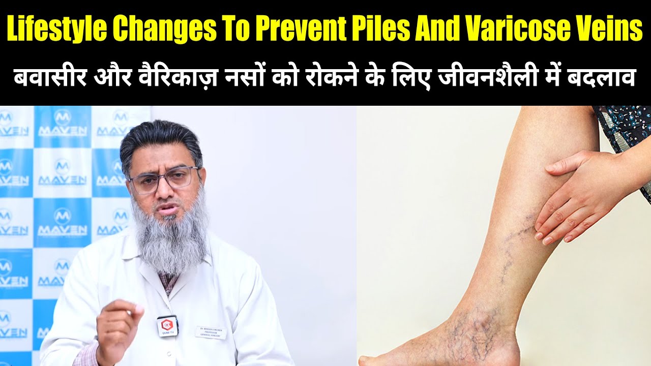 Lifestyle Changes To Prevent Piles And Varicose Veins | Dr. Rehan Sabir ...