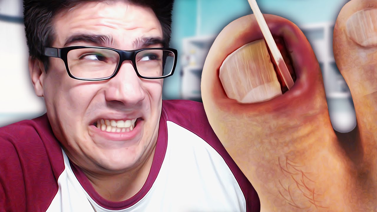 O VÍDEO MAIS NOJENTO!! - YouTube