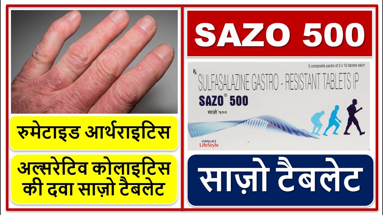 रुमेटाइड आर्थराइटिस, अल्सरेटिव कोलाइटिस की दवा साज़ो टैबलेट, SAZO 500 ...