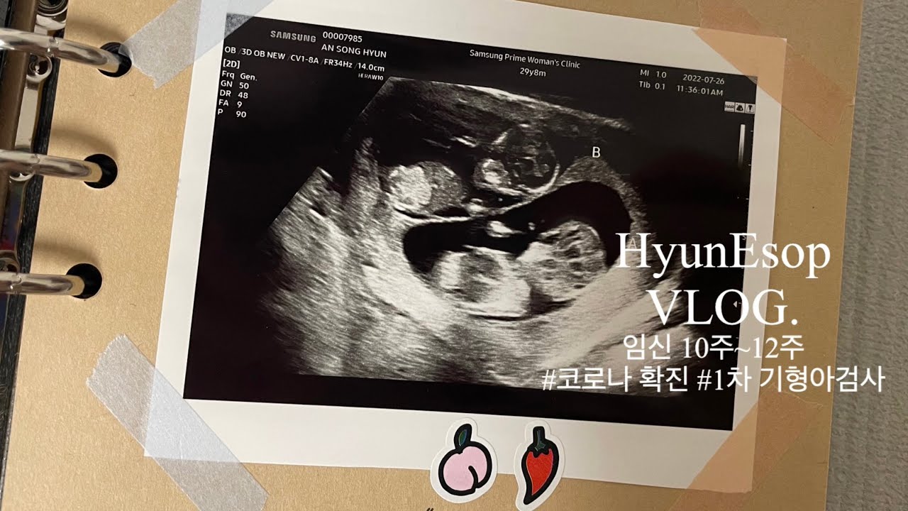 Vlog 쌍둥이임산부 둥이임신 10주~12주차 코로나 확진 자가격리 1차 기형아검사 일상유희 초음파