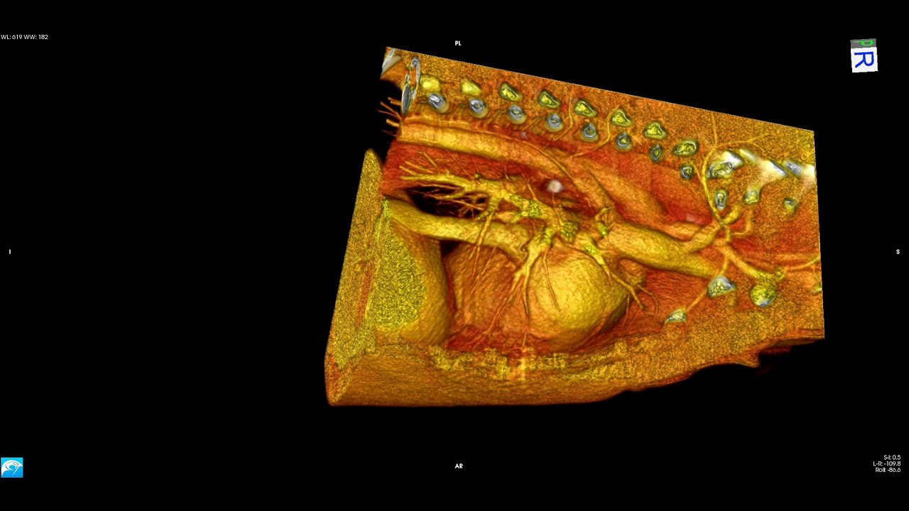 Vascular ring anomaly PRAA found in puppy by Vimago HDVI - YouTube