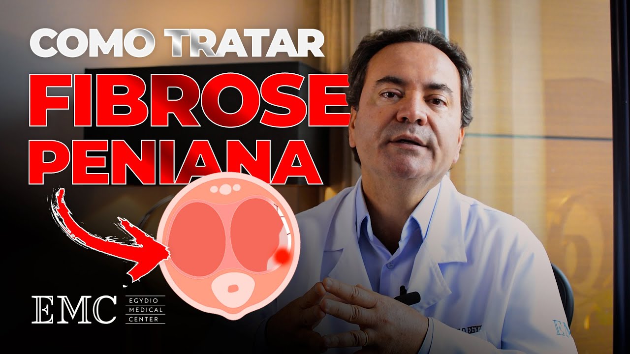 Como tratar a fibrose peniana? | Dr. Paulo Responde! - YouTube