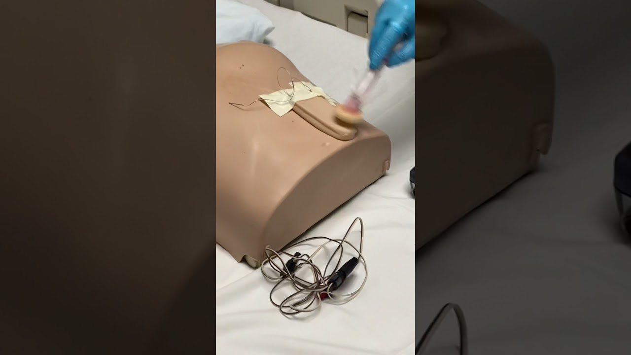 epicardial pacing wire hook up - YouTube