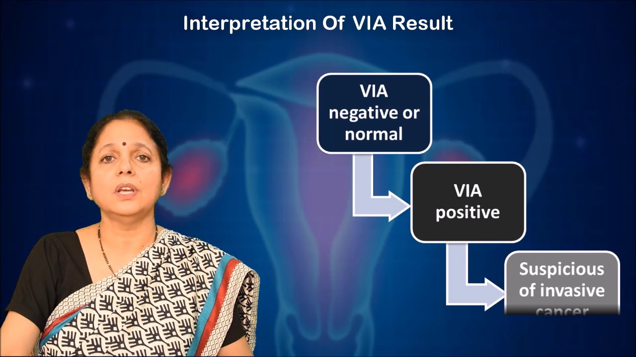 Visual Inspection With Acetic Acid VIA YouTube