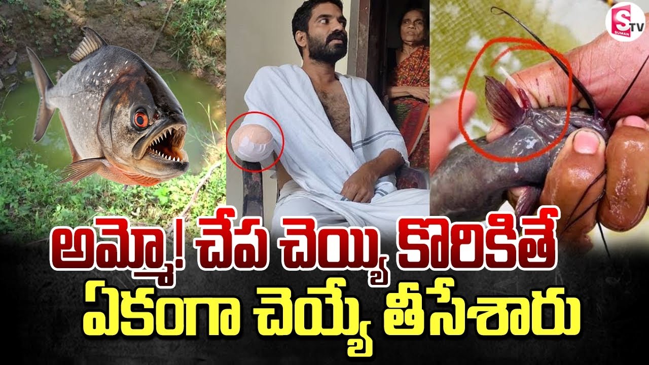 చేప కొరికితే చెయ్యి తీసేశారు | Kerala Doctors Removed Man's Hand After Fish Bite - YouTube