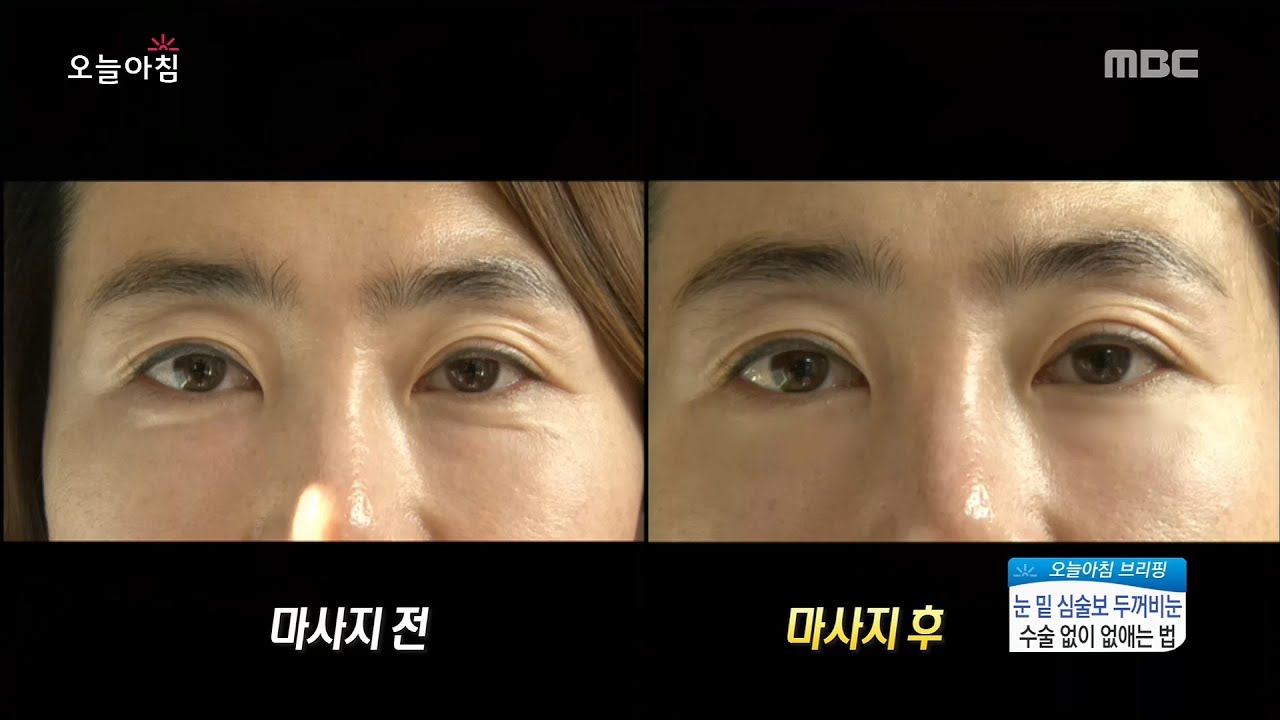 Morning Show eye Easy Care At Home Morning Show eye Easy Care At Home