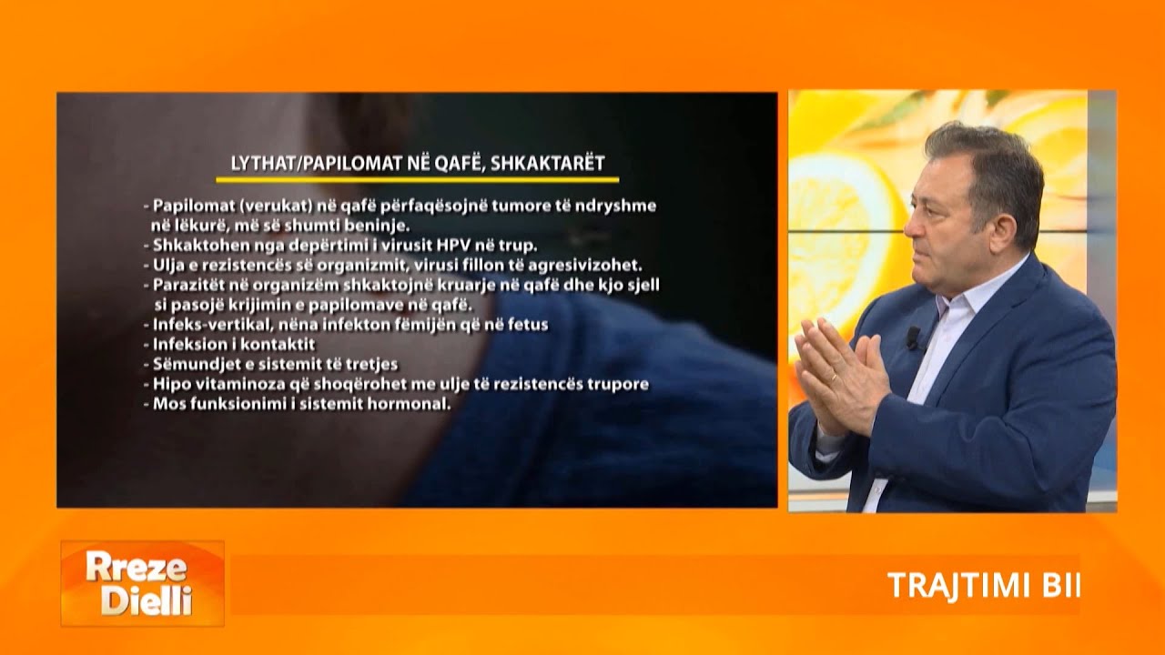 Nga parazitët tek infeksionet… zbuloni shkaktarët e lythave dhe ...