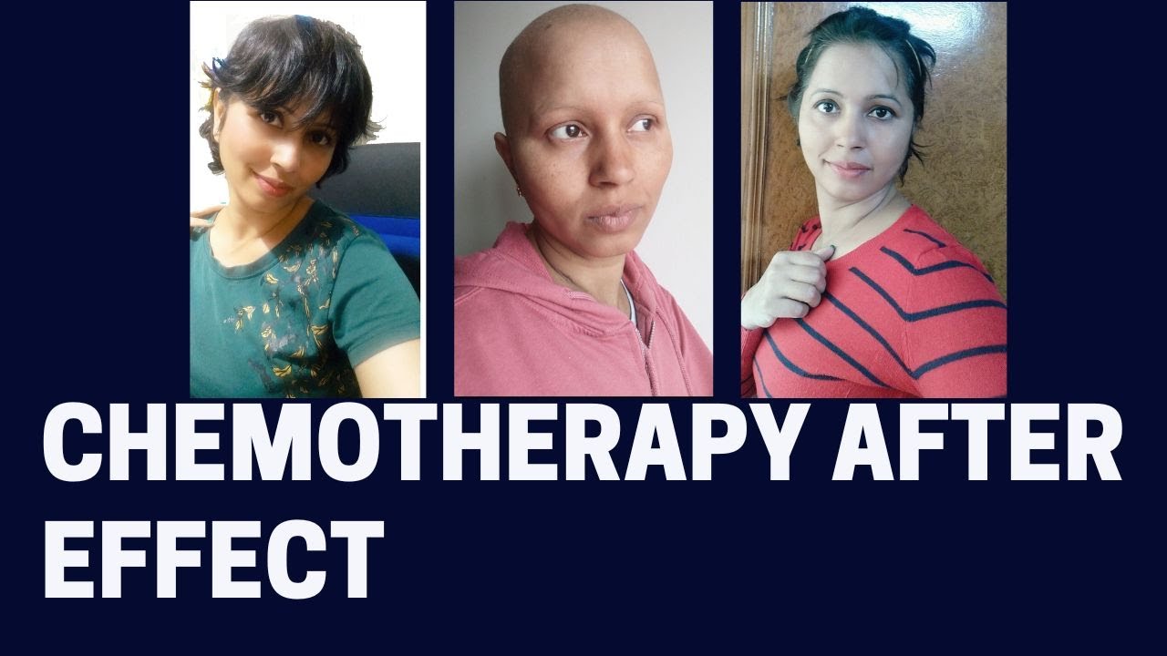 Side effects from chemotherapy after 3 years.... मेरे शरीर में होने ...
