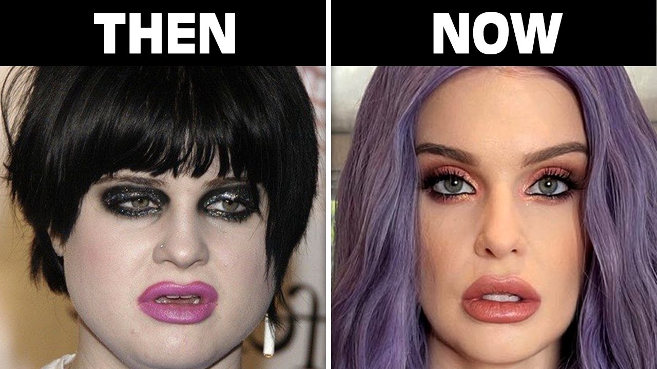 BOTCHED Plastic Surgeries That Celebrities Tried To Hide - YouTube
