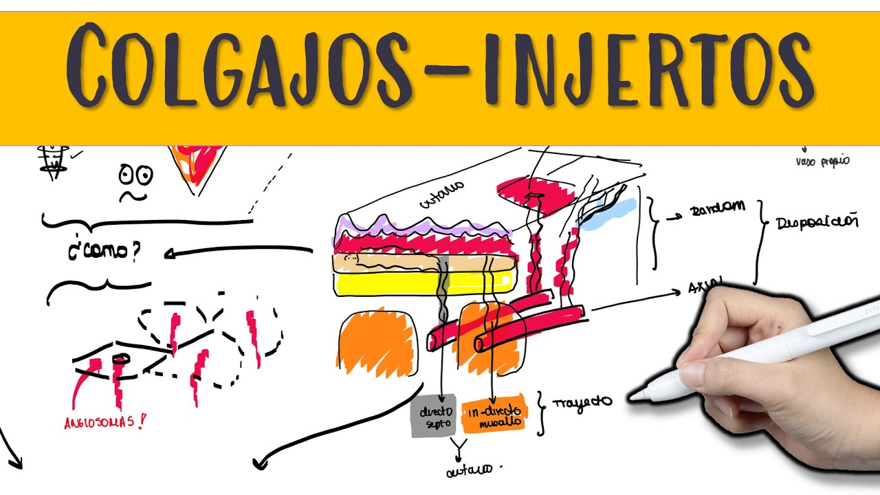 INJERTOS Y COLGAJOS #axial #random #fasciocutaneo #musculocutaneo # ...