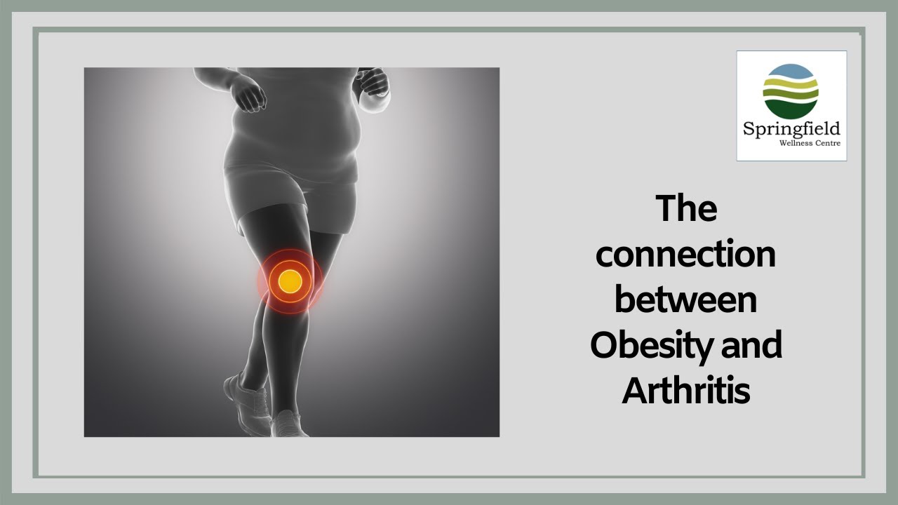 The connection between Obesity and Arthritis | Dr Maran on influence of ...