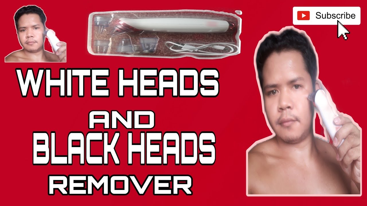 Easy Black Heads And White Heads Remover Tagalog Review YouTube easy-black-heads-and-white-heads-remover-tagalog-review-youtube