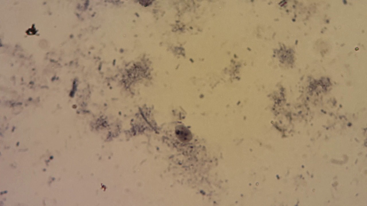 Endolimax nana _ cyst - YouTube