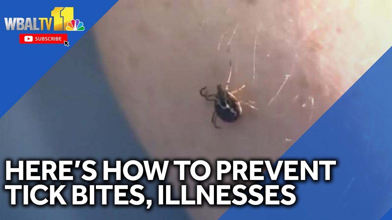 Here's how to prevent tick bites and illnesses - YouTube