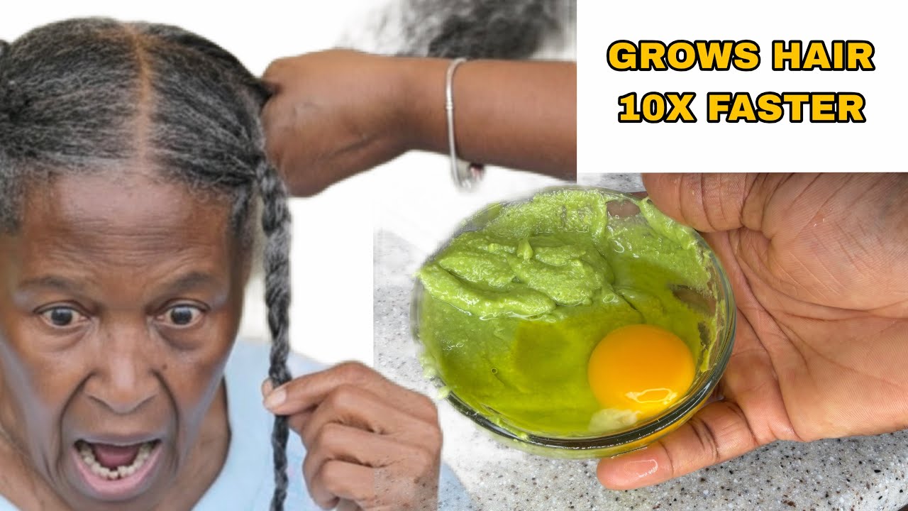 I HAVEN'T seen ANYTHING GROW hair this fast!This hair growth recipe ...