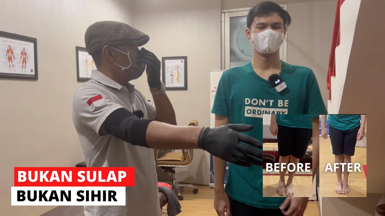 TREATMENT BONE SETTING GENU VALGUM / KAKI X - YouTube