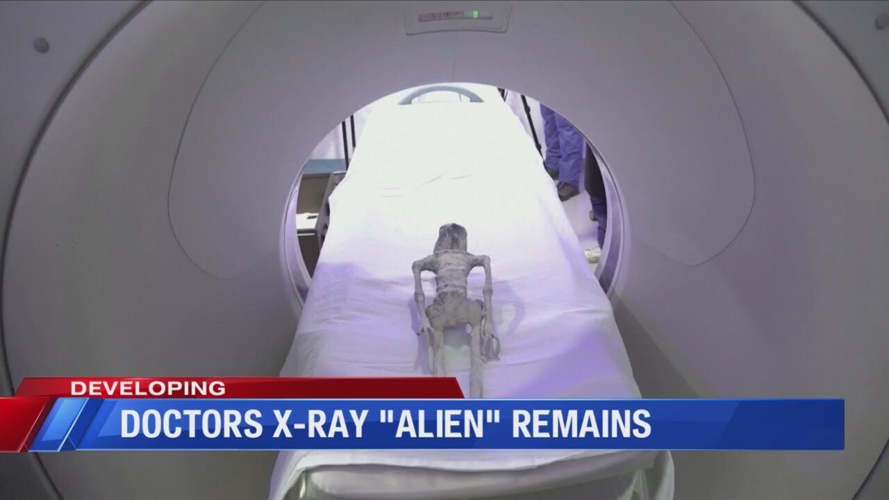 Doctors X-Ray 'Alien' remains - YouTube