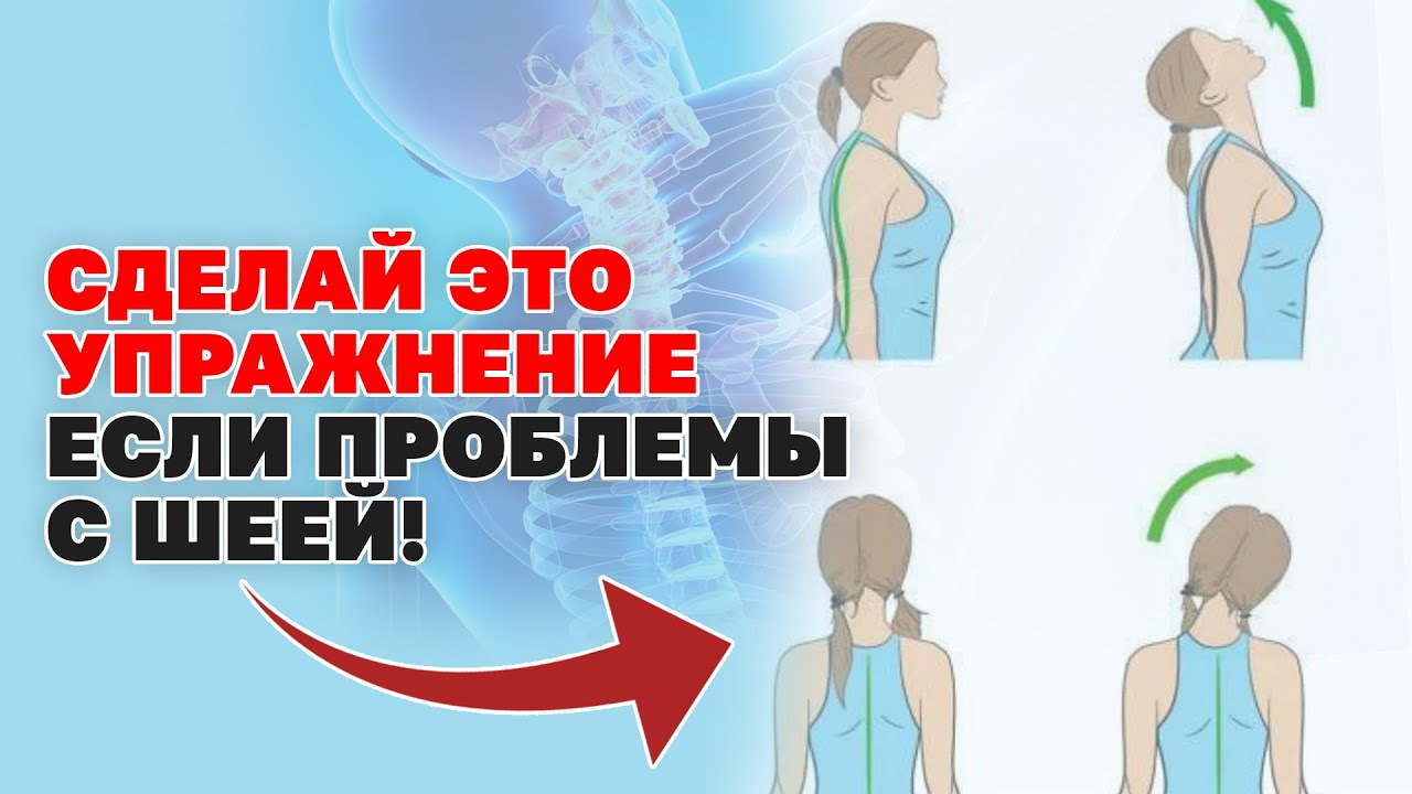 Лучший комплекс при остеохондрозе шеи Делай эти упражнения Гимнастика