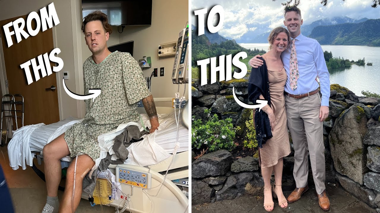 Astonishing 2-Week Transformation After Surgery - YouTube