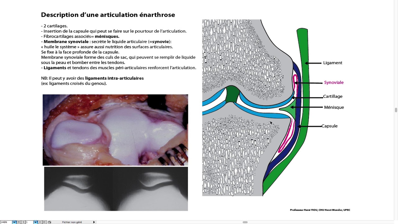22_Description d'une énarthrose - YouTube
