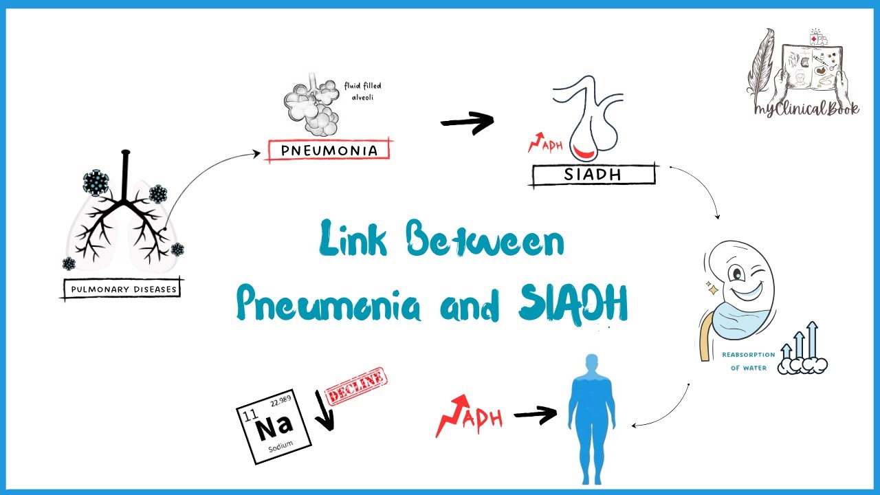 Understanding the Link Between Pneumonia and SIADH - it’s ...