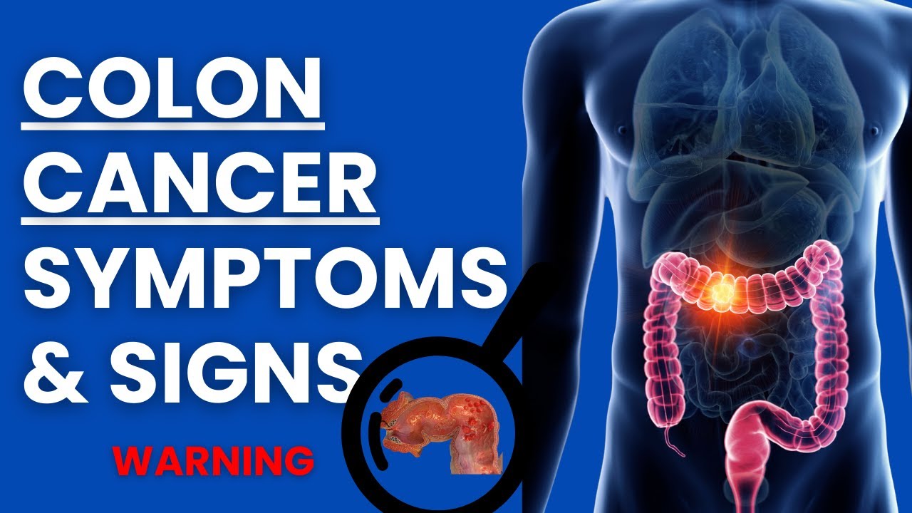 Colon Cancer Symptoms And Signs You Should NEVER Ignore!! - YouTube