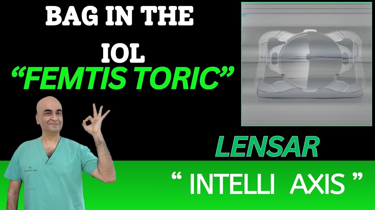 FEMTIS TORIC IOL with LENSAR "INTELLI AXIS " ! Dr Kamal B Kapur - YouTube
