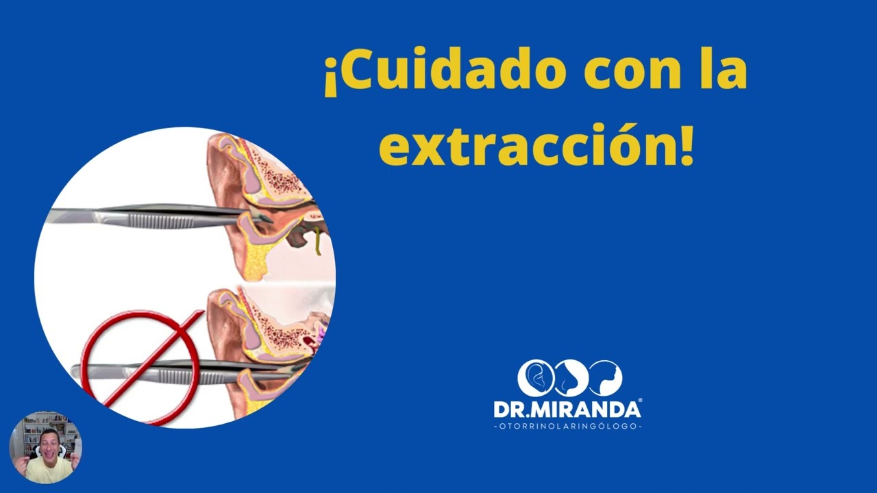 ¿Que hacer si un insecto se mete en tu oído - YouTube