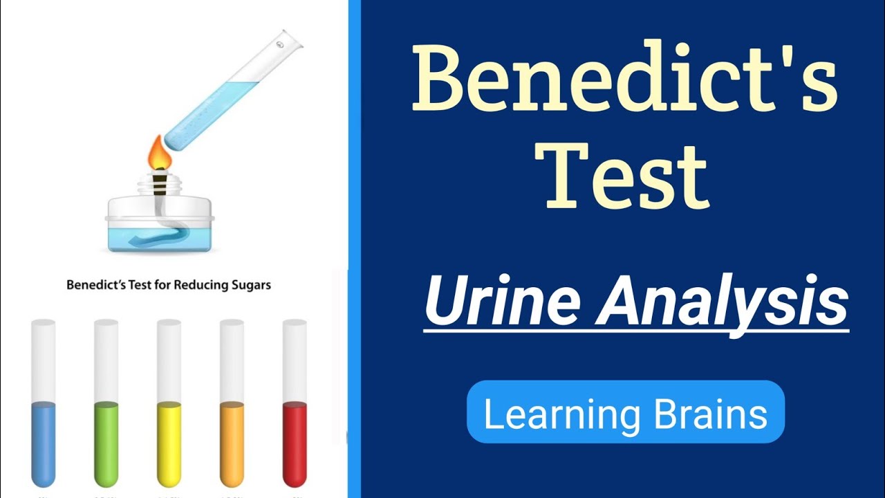 Benedict's Test: Principle, Procedure & Results Explained # ...