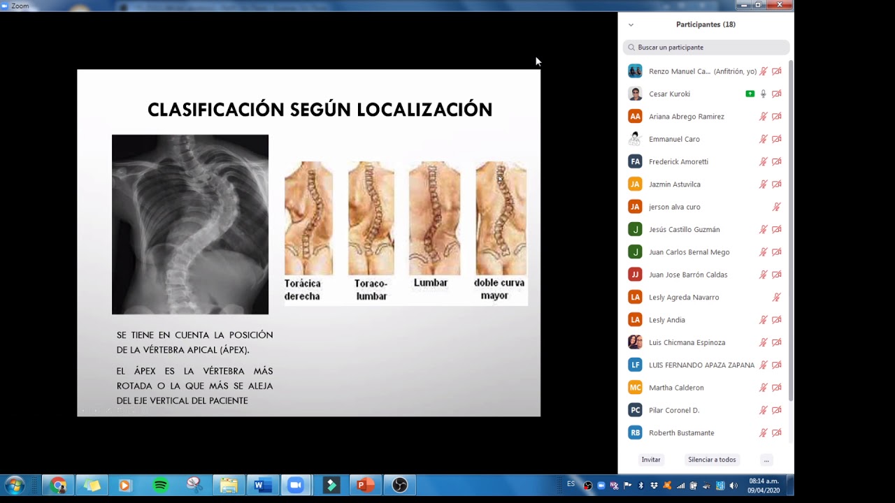 DEFECTOS POSTURALES DR KUROKI - YouTube