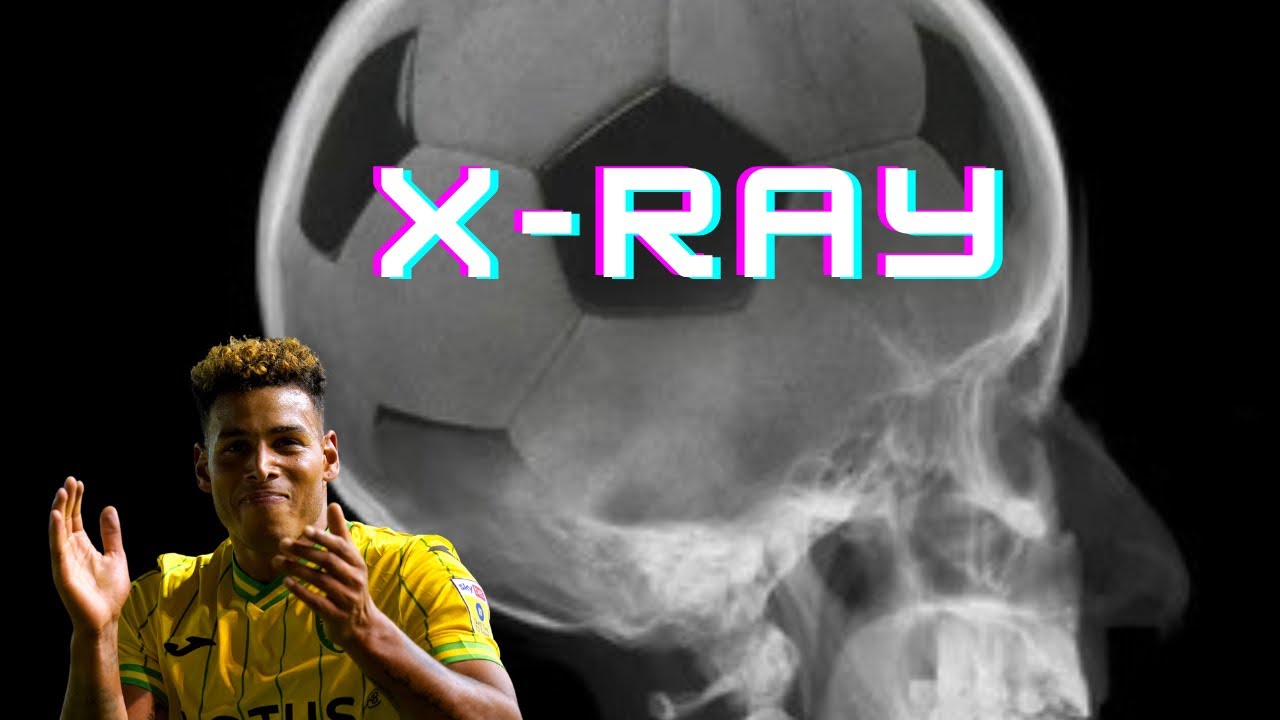 Good X-ray results, keep going.. - YouTube