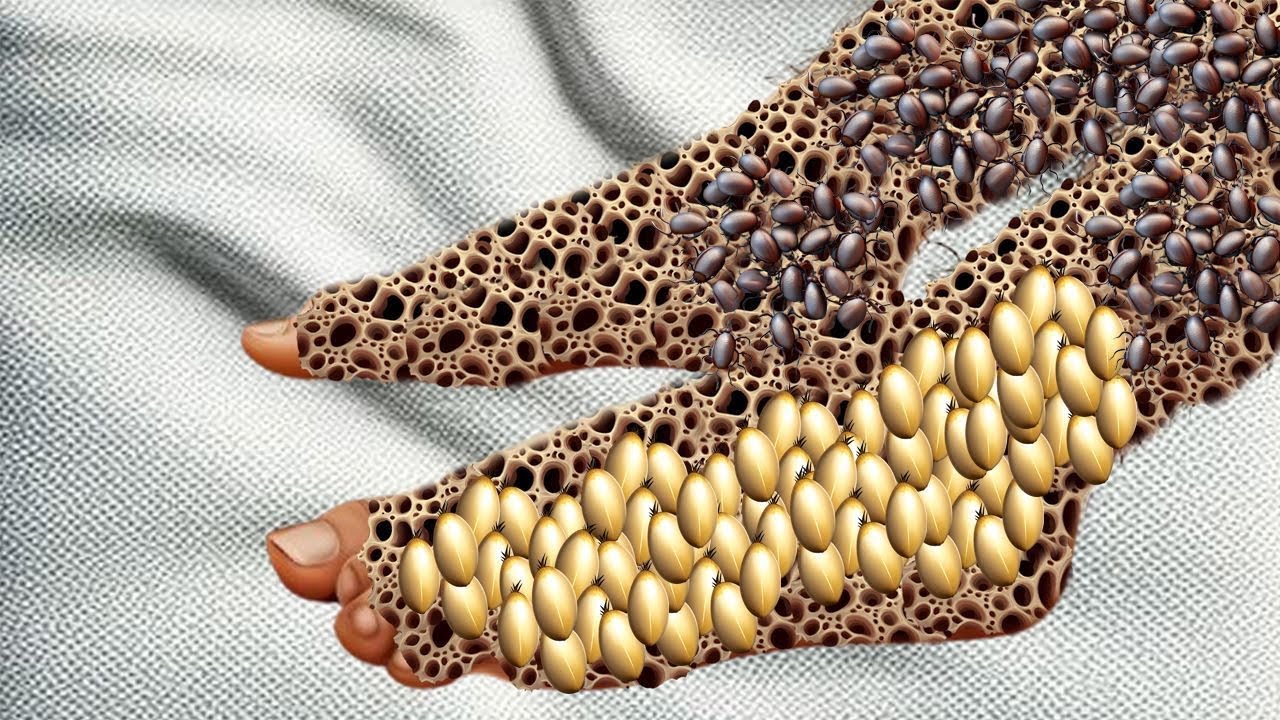 Unbelievable Spongy Foot Treatment ASMR ANIMATION - YouTube