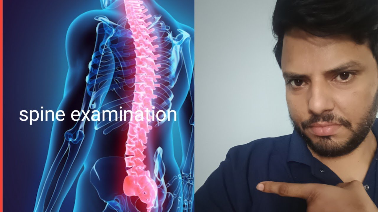 Spine examination | How to examine spine - YouTube
